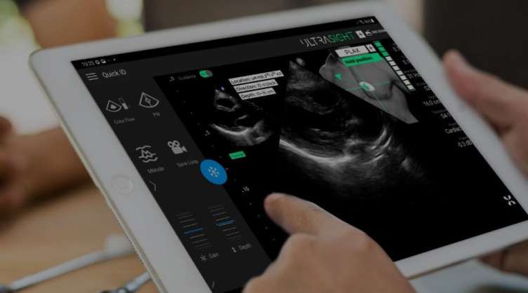 FDA Clearance for UltraSight's Cardiac AI Imaging
